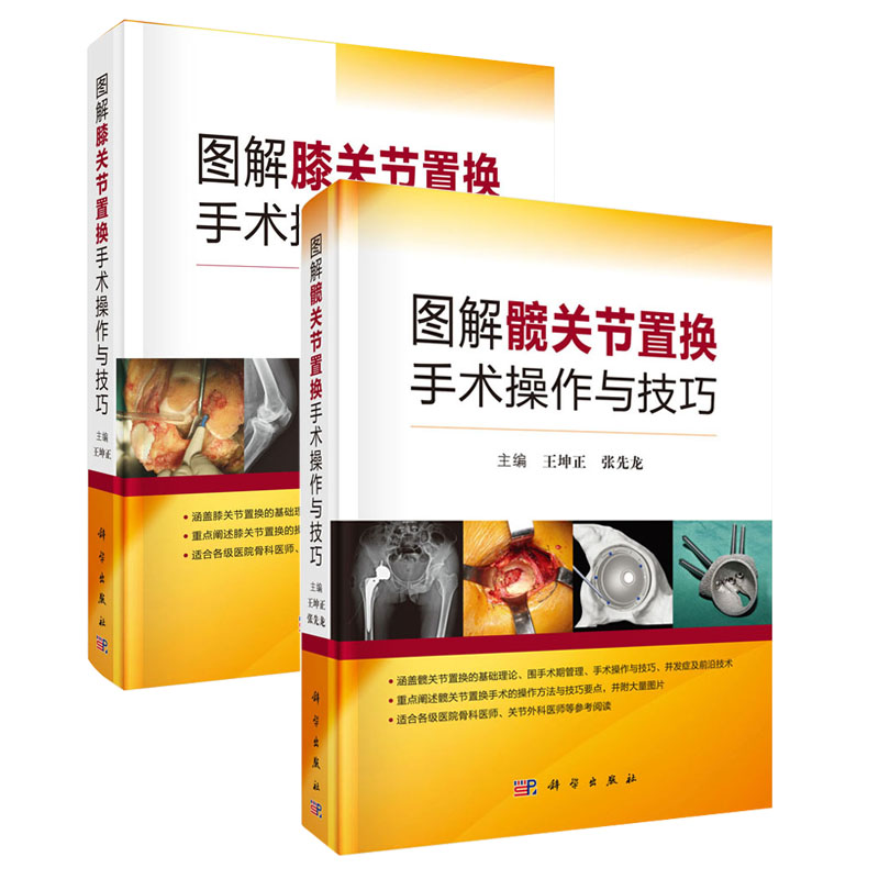 现货 【套装2本】图解髋关节置换手术操作与技巧+ 图解膝关节置换手术操作与技巧 髋关节置换基础理论书