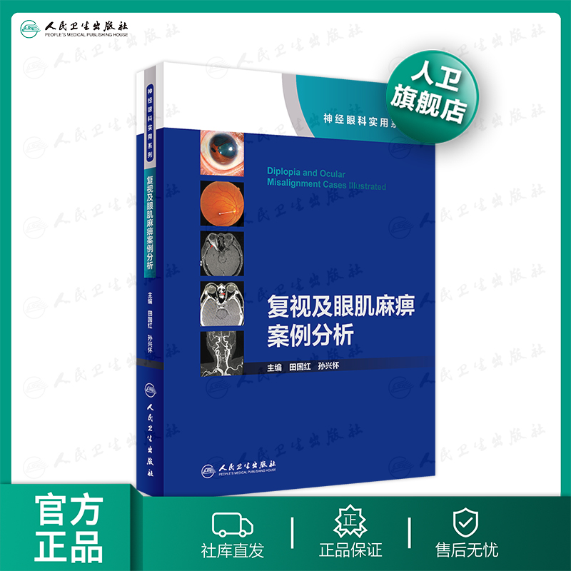 复视及眼肌麻痹案例分析（神经眼科实用系列）2020年12月参考书