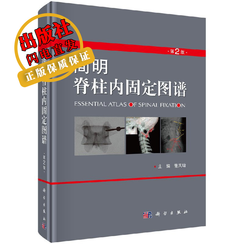 简明脊柱内固定图谱（第2版）