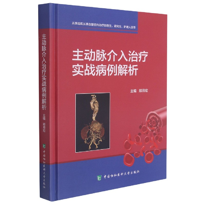 主动脉介入治疗实战病例解析