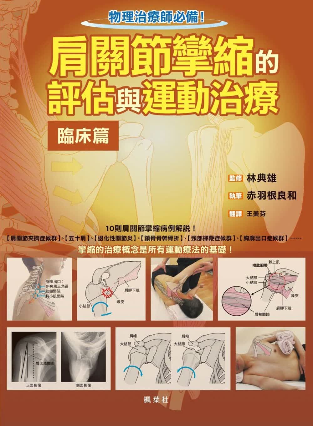 预售 原版进口书 赤羽根良和肩关节挛缩的评估与运动治疗 临床篇枫叶社文化台版原版书籍