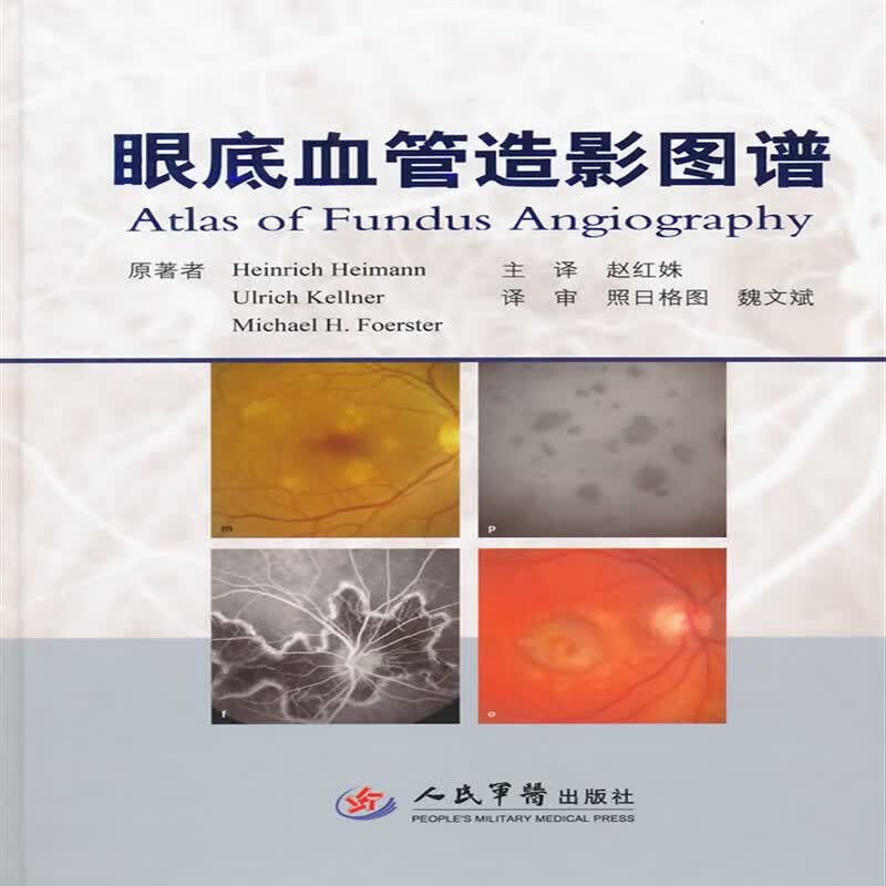 眼底血管造影图谱 眼底血管造影图谱