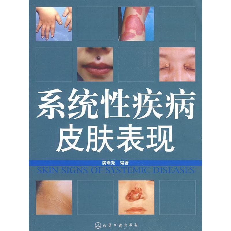 系统性疾病皮肤表现 虞瑞荛编著【书】