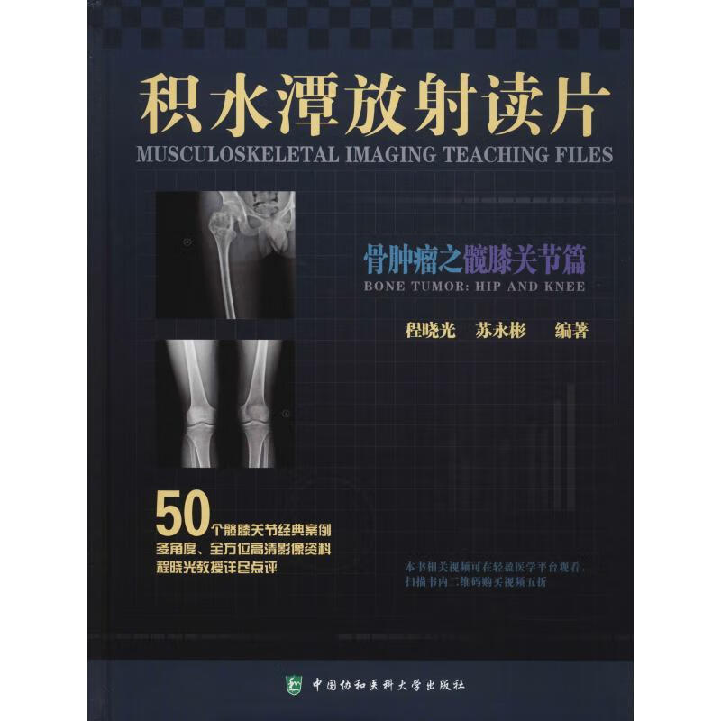 积水潭放射读片 骨肿瘤之髋膝关节篇