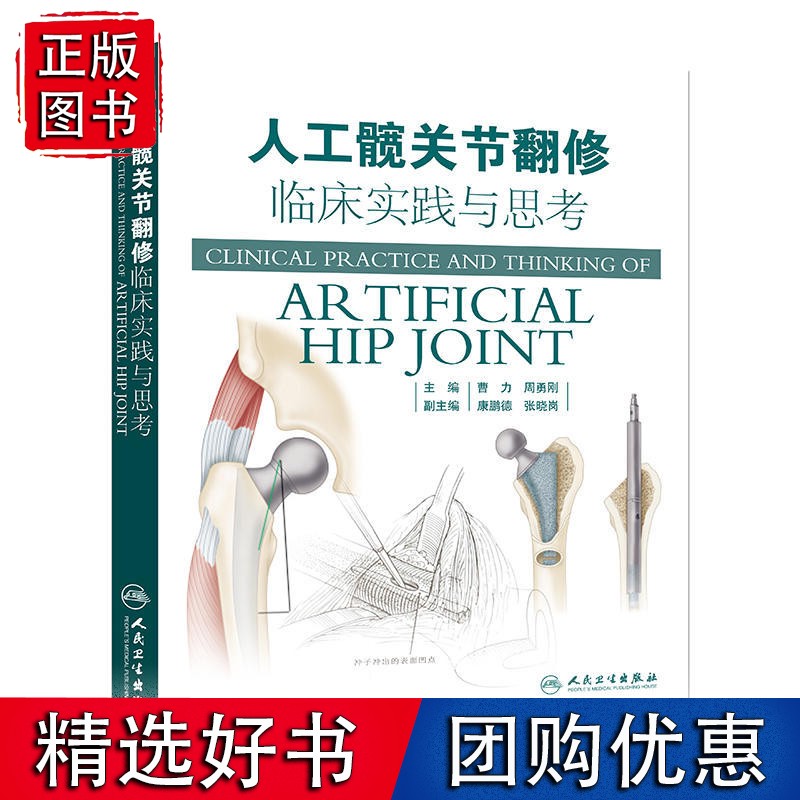 人工髋关节翻修临床实践与思考