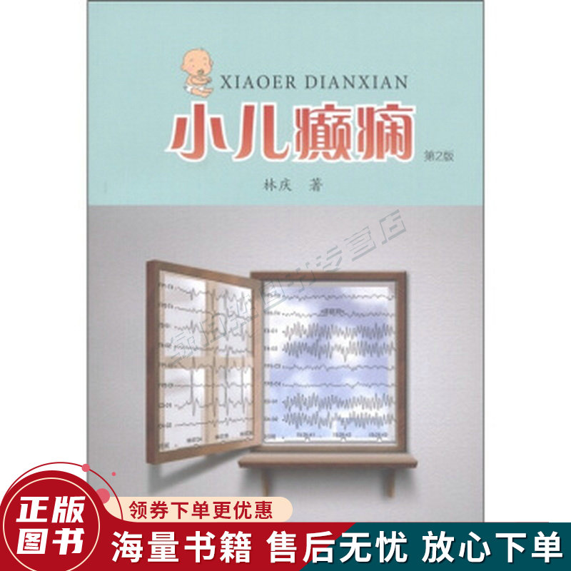 小儿癫痫第2版