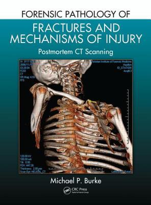 Forensic Pathology of Fractures and Mechanisms o