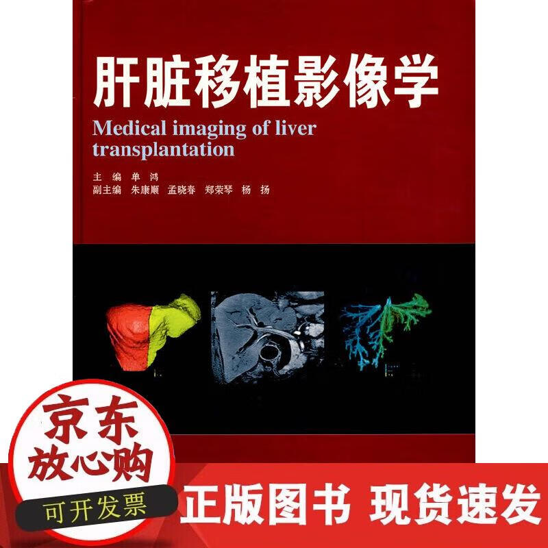 【现货】肝脏移植影像学