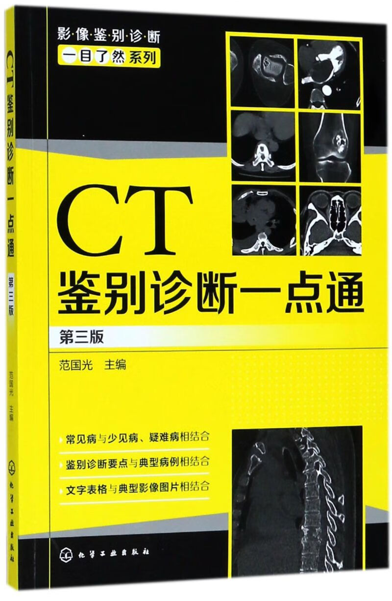 CT鉴别诊断一点通(第3版)/影像鉴别诊断一目了然系列