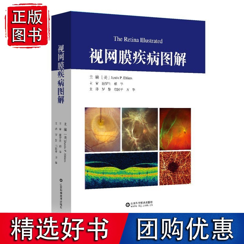 视膜疾病图解