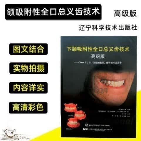 下颌吸附性全口总义齿 高级版
