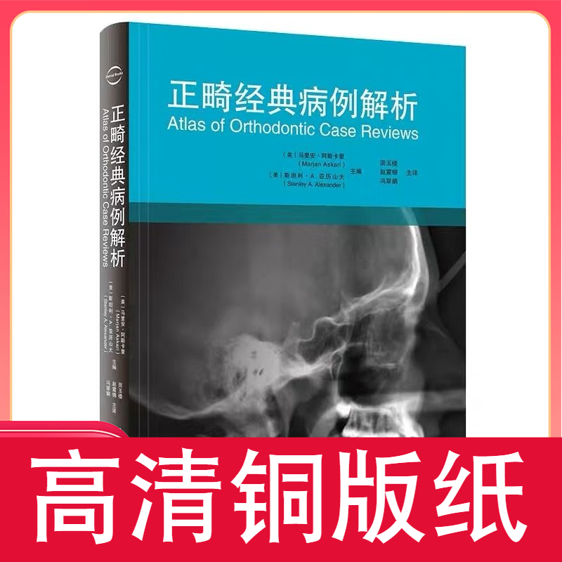 正畸病例解析 铜版纸