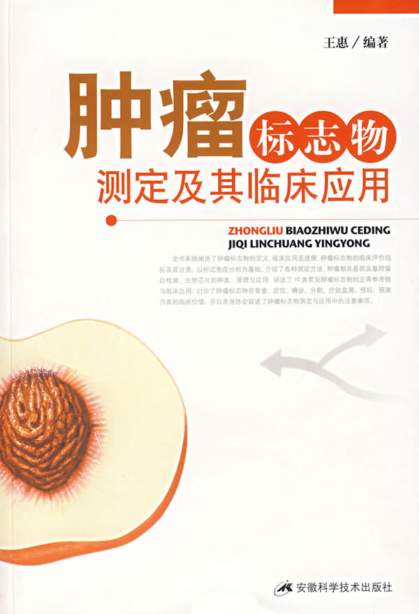 肿瘤标志物测定及其临床应用 王惠编著【书】