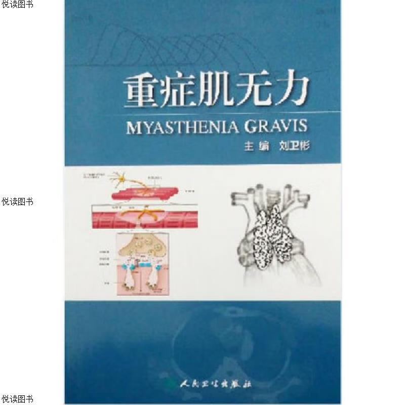重症肌无力