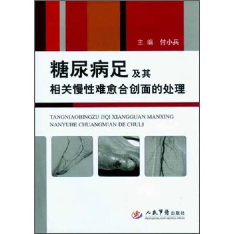糖尿病足及其相关慢性难愈合创面的处理 付小兵 【好书，下单速发】