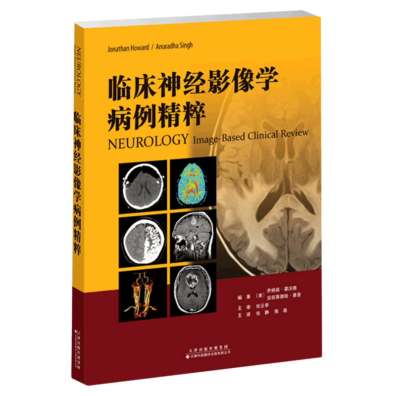 临床神经影像学病例精粹