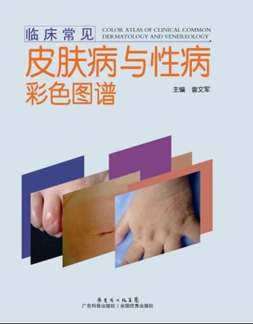 临床常见皮肤病与彩色图谱曾文军医学9787535962591