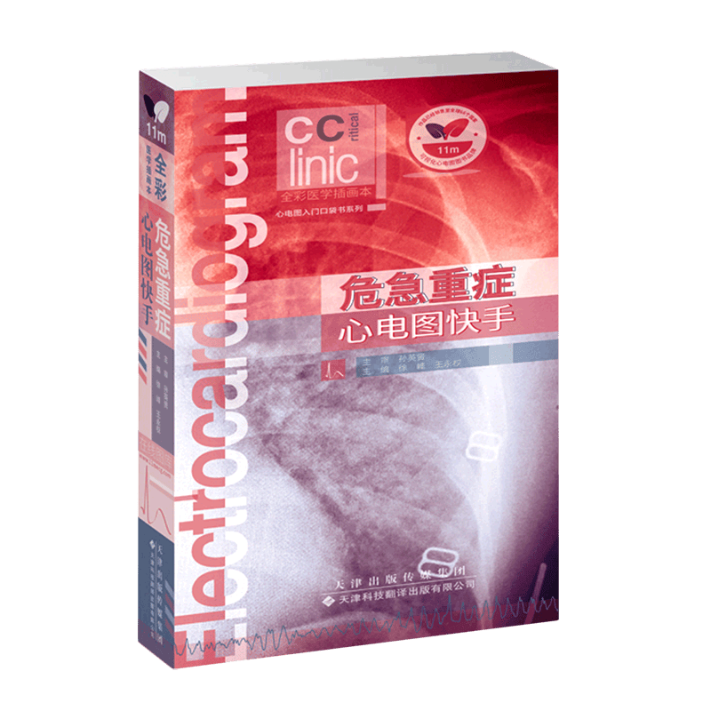 危急重症心电图快手(全彩医学插画本)/心电图入门口袋书系列