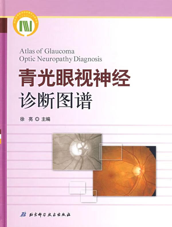 青光眼视神经诊断图谱