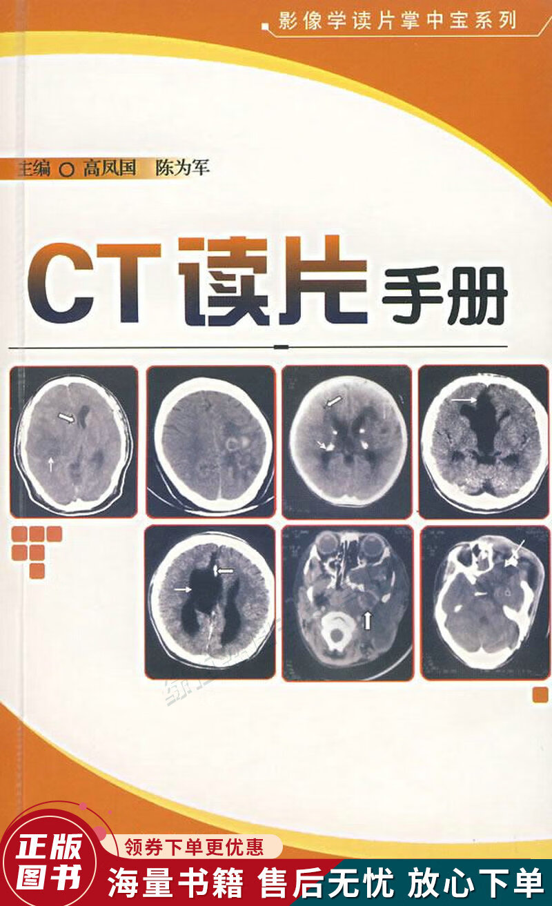 CT读片手册