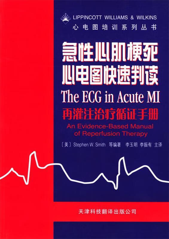 急性心肌梗死心电图快速判读