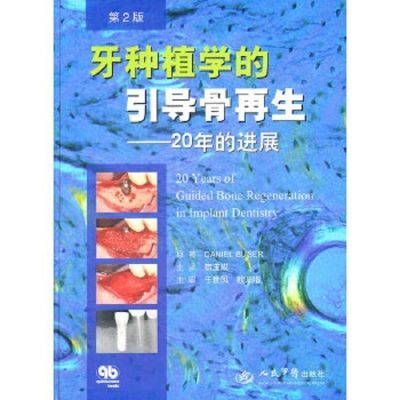 高清彩色 牙种植学的引导骨再生 20年的进展 主译 宿玉成 高清彩色 牙种植学的引导骨再生 20年的进展