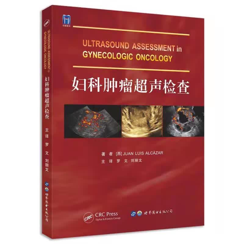 妇科肿瘤超声检查《现货速发》