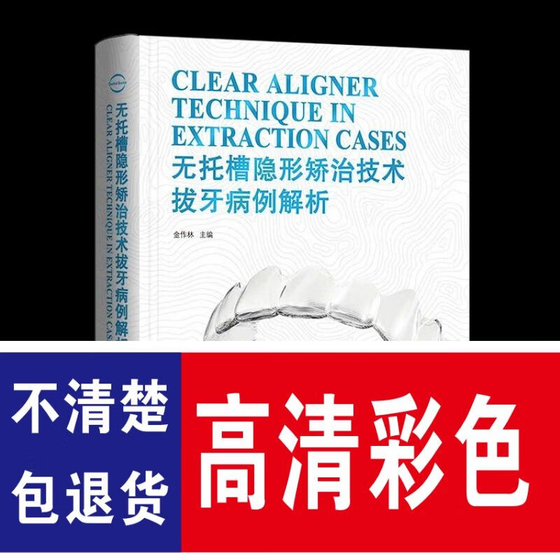 无托槽隐形矫治拔牙病例解析