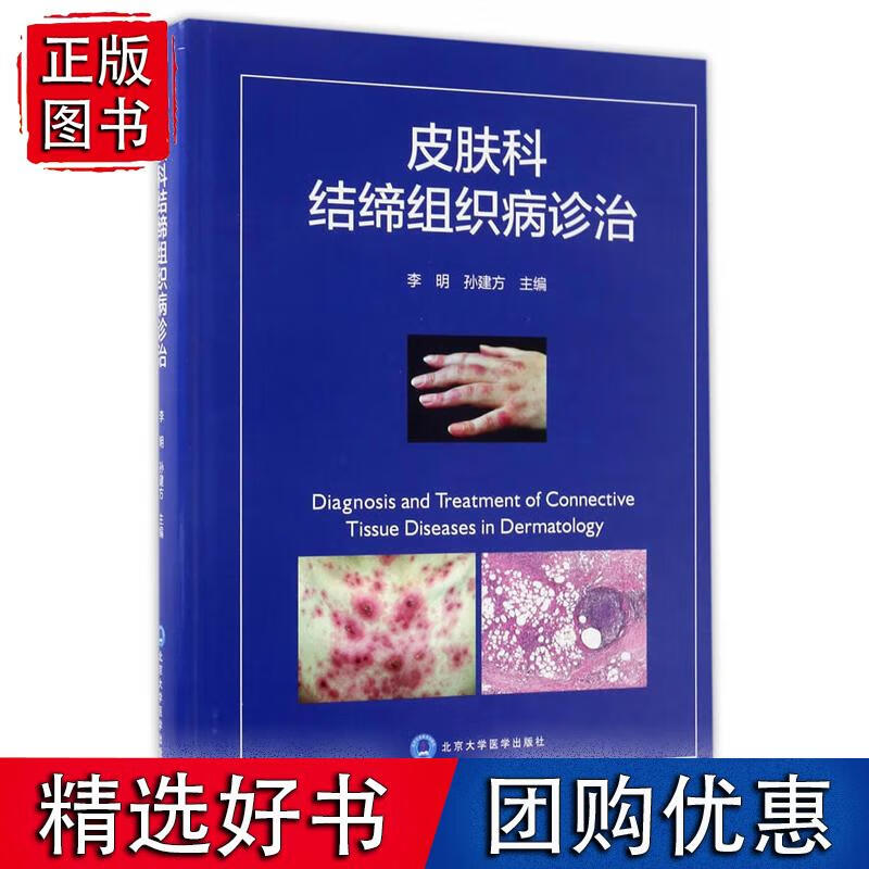 皮肤科结缔组织病诊治