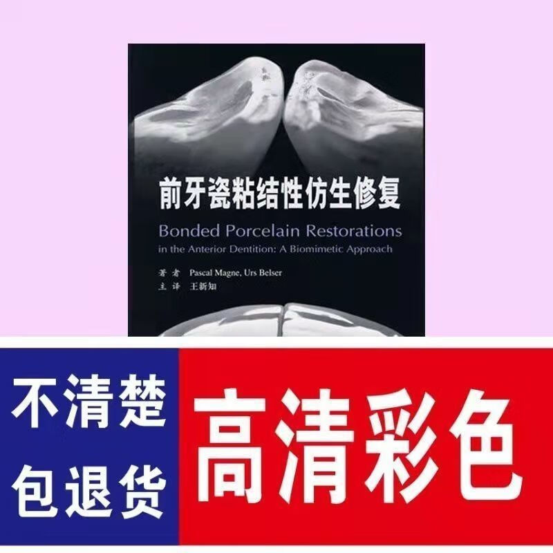 高清彩色 前牙瓷粘结性仿生修复