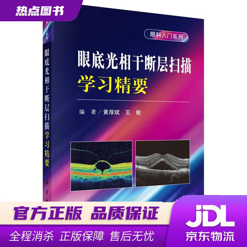 眼底光相干断层扫描学习精要--眼科入门系列 黄厚斌,王敏 科学出版社