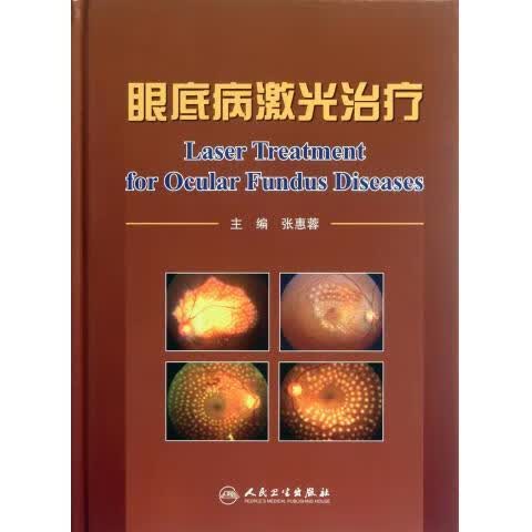 眼底病激光治疗 张惠蓉 人民卫生出版社