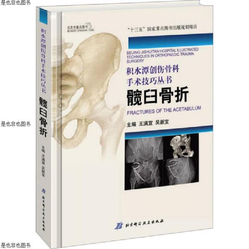 积水潭创伤骨科手术技巧：髋臼骨折