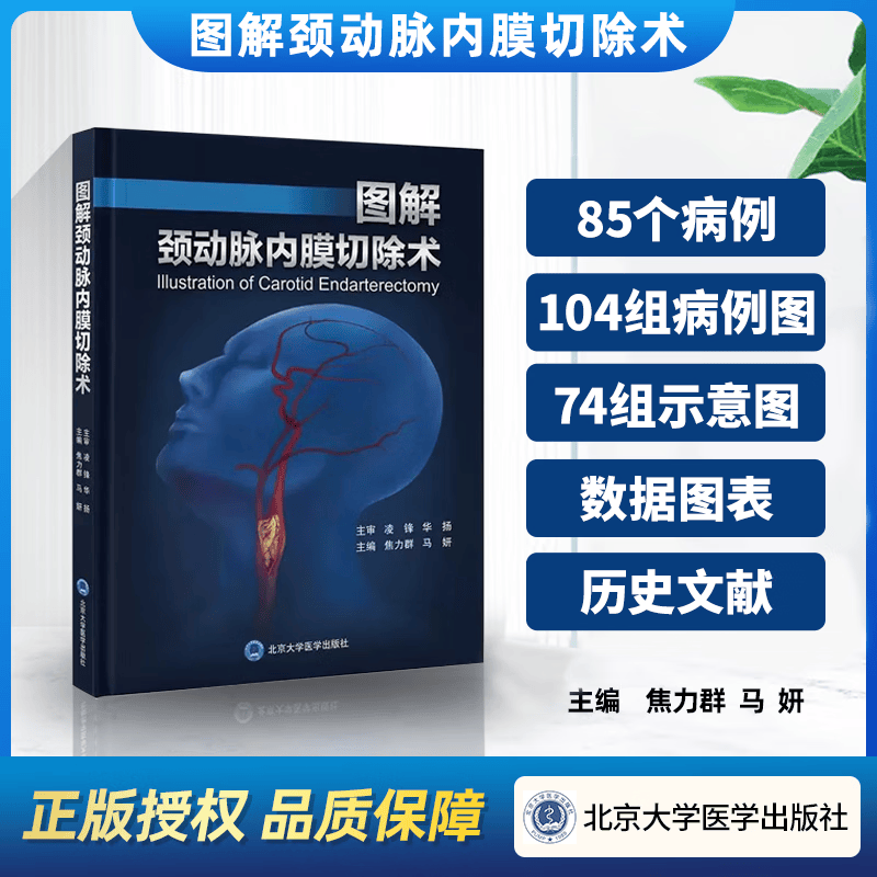 图解颈动脉内膜切除术 焦力群 马妍 宣武医院脑缺血治疗系列丛书 围术期影像学评估手术操作细节 北京大学医学出版社9787565927652