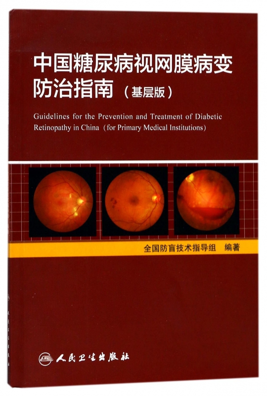 中国糖尿病视网膜病变防治指南(基层版)