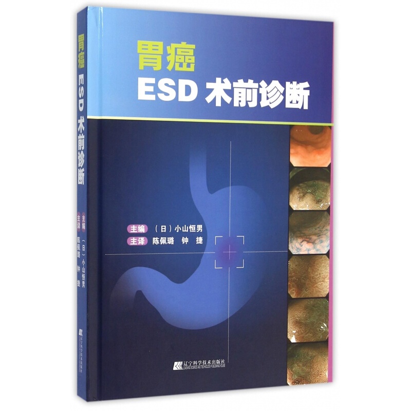 胃癌ESD术前诊断(精)..。。