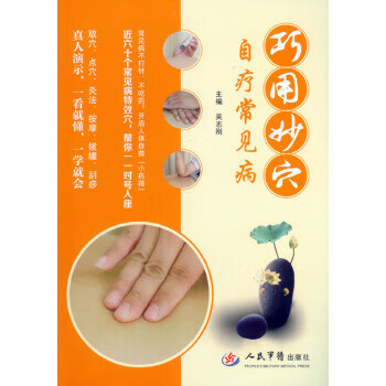 巧用妙穴自疗常见病