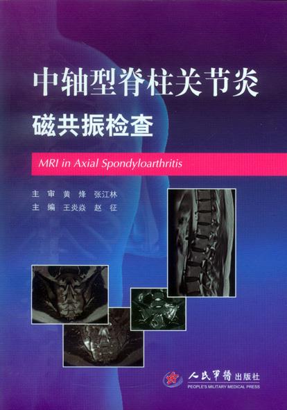 中轴型脊柱关节炎磁共振检查