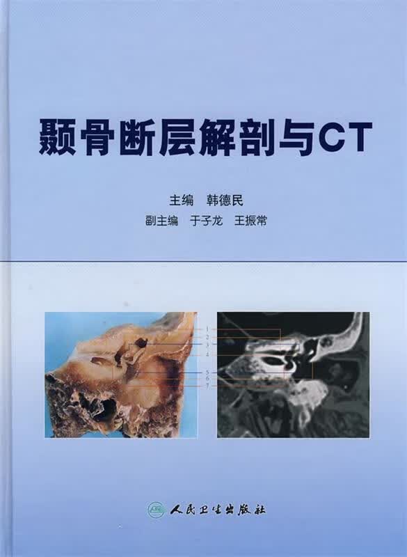 颞骨断层解剖与CT 韩德民 主编