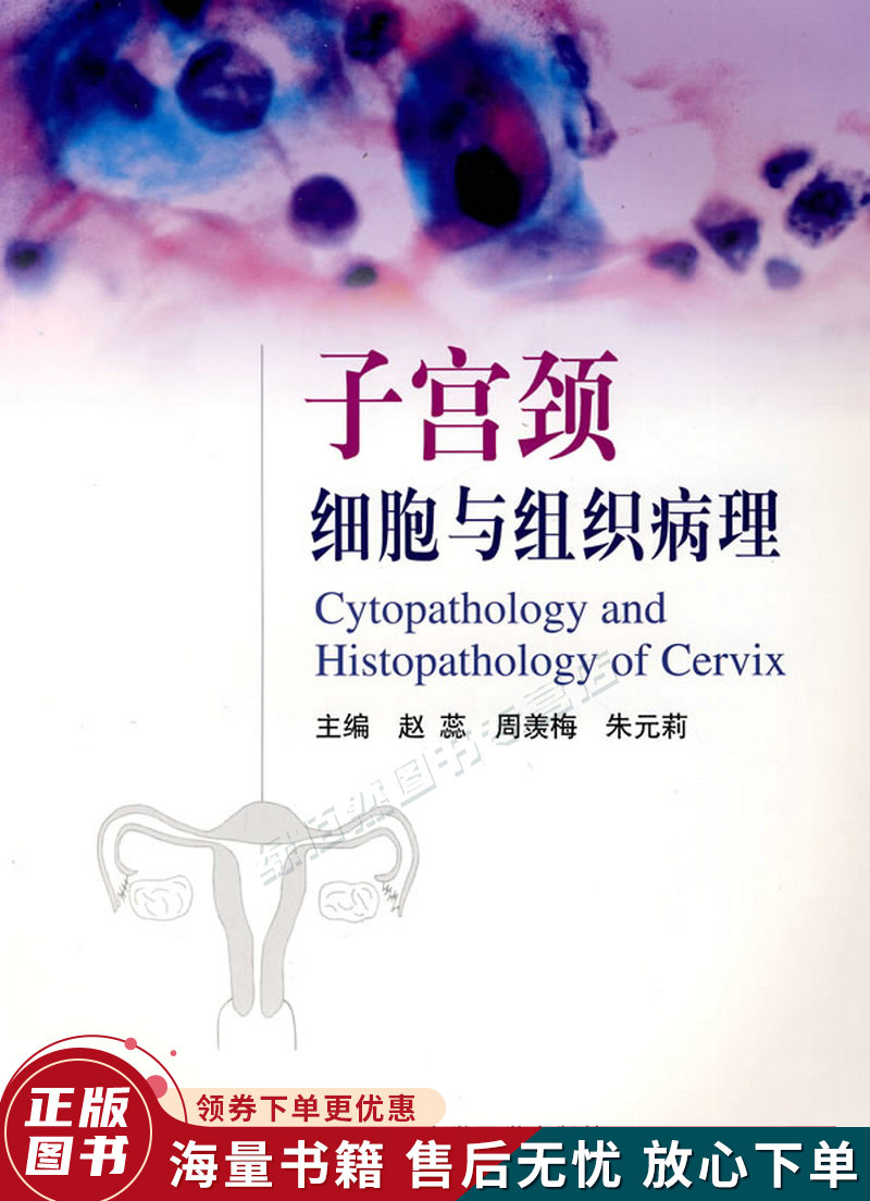 子宫颈细胞与组织病理