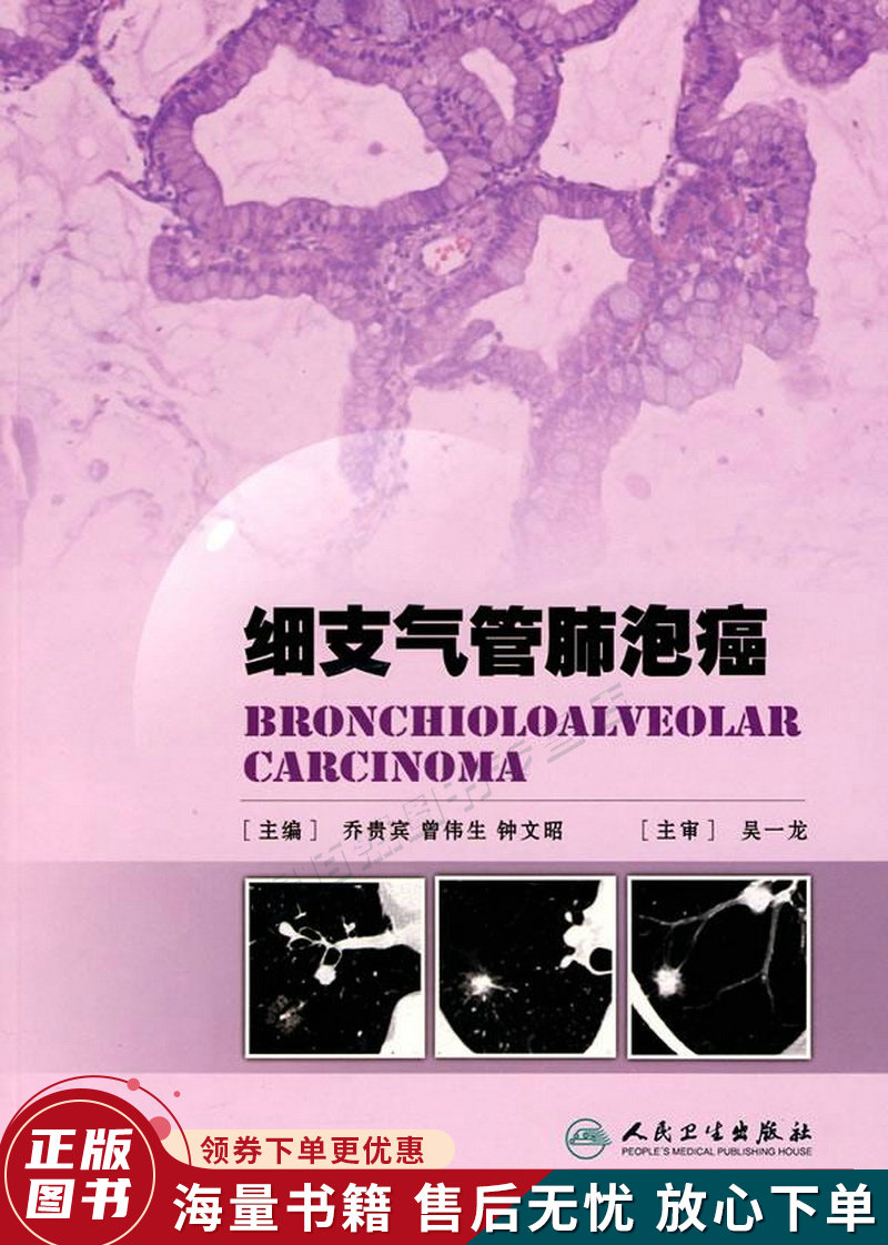 细支气管肺泡癌
