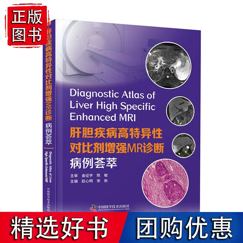 肝胆疾病高特异性对比剂增强MR诊断:病例荟萃