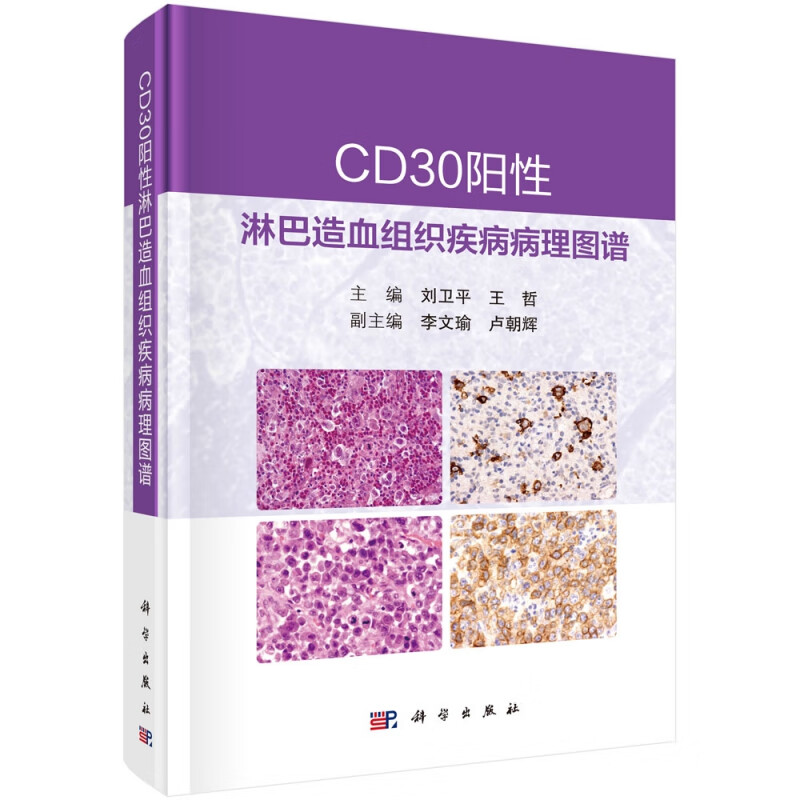 CD30阳性淋巴造血组织疾病病理图谱