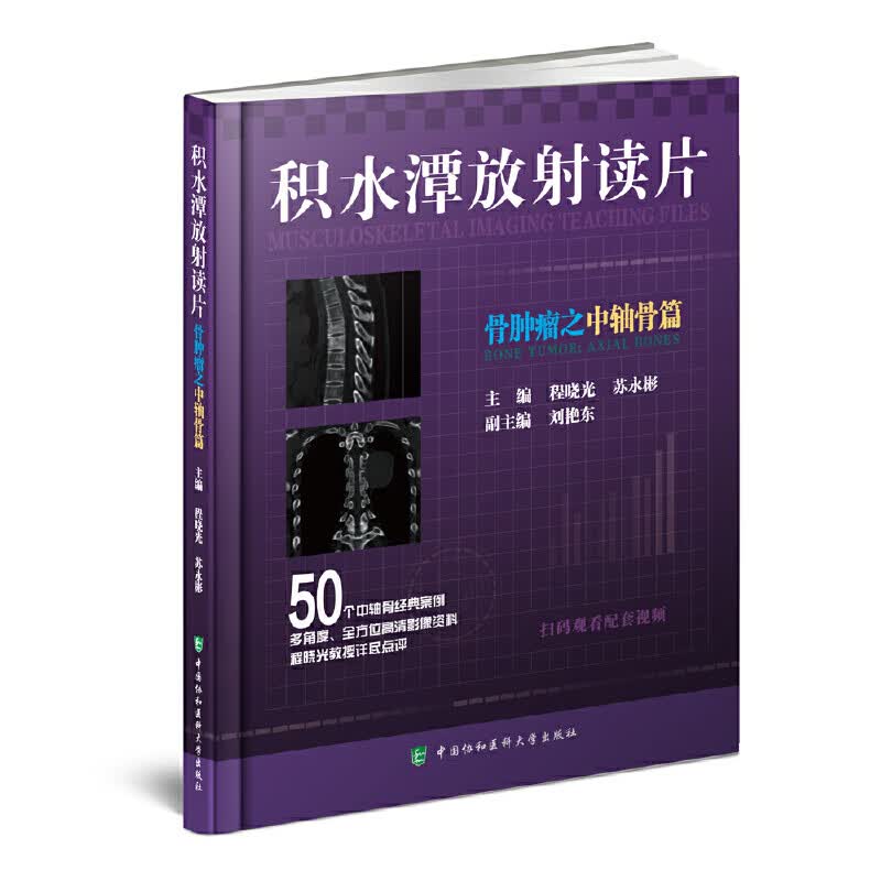 积水潭放读片