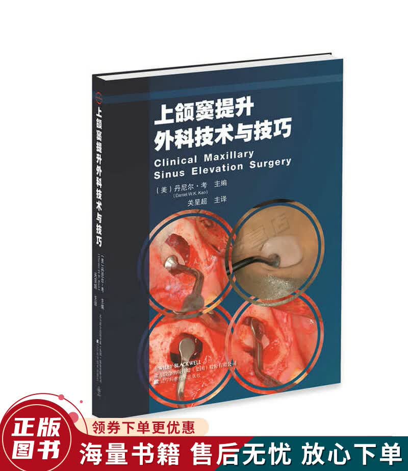 上颌窦提升外科技术与技巧