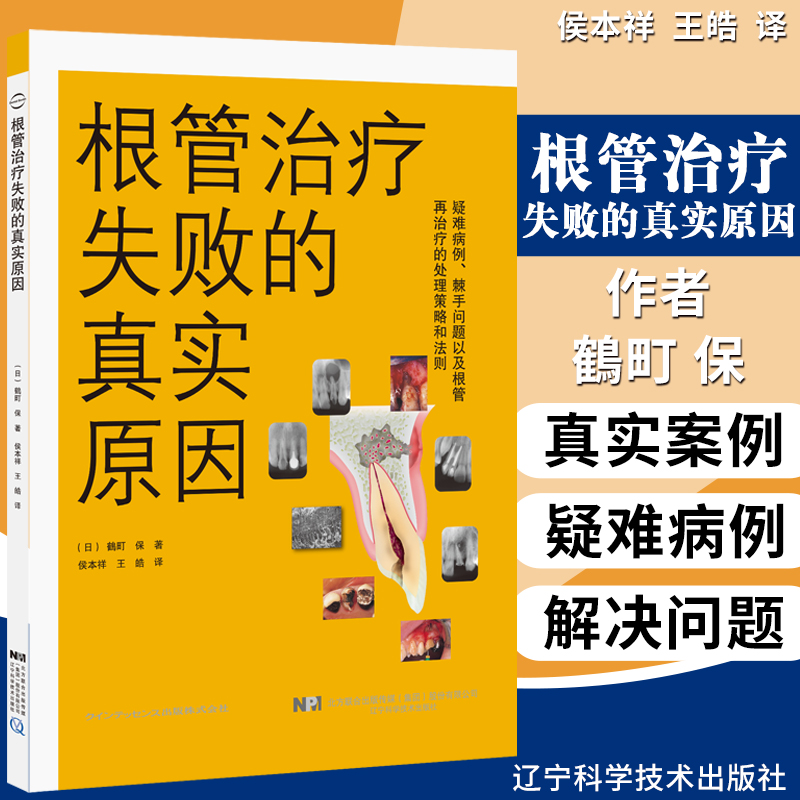 根管治疗失败的真实原因 日鶴町保著侯本祥王皓译 口腔修复正畸种植学医学类专业书籍图谱牙体牙髓病真正根尖周病变辽宁科技出版社