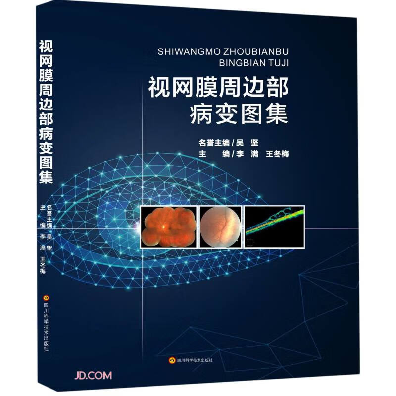 视网膜周边部病变图集(精)《现货速发》
