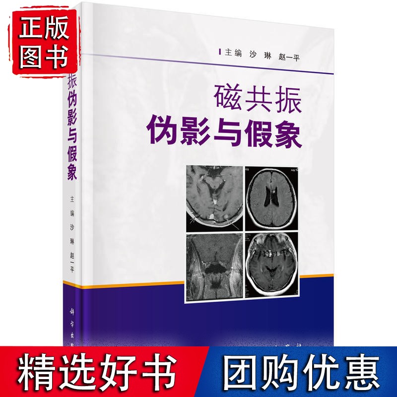 磁共振伪影与假象