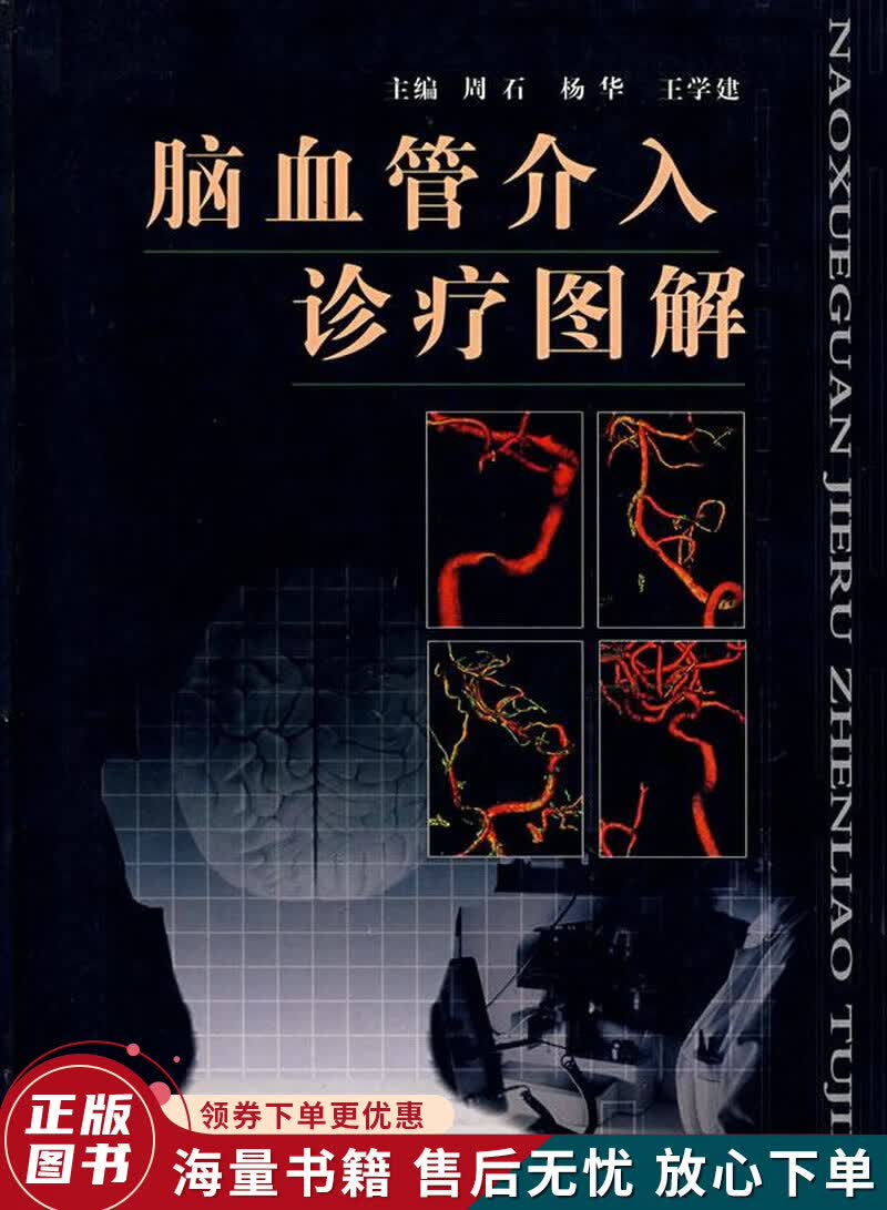 脑血管介入诊疗图解
