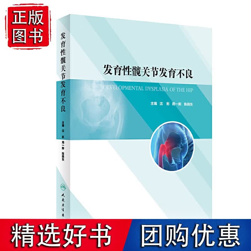 发育性髋关节发育不良